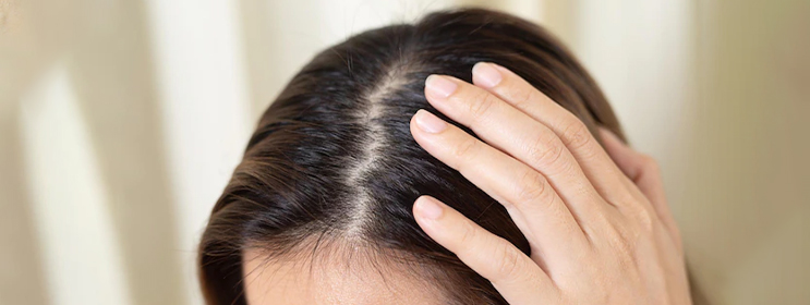 Here’s How To Find Out Your Scalp Type? - Clovia Blog